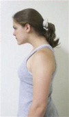 Foward Head Posture - Advanced Chiropractic Clinic - Niagara Falls ON